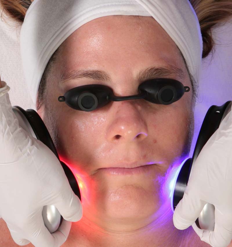 HydraFacial to restore, brighten and hydrate skin in Irvine, Orange County